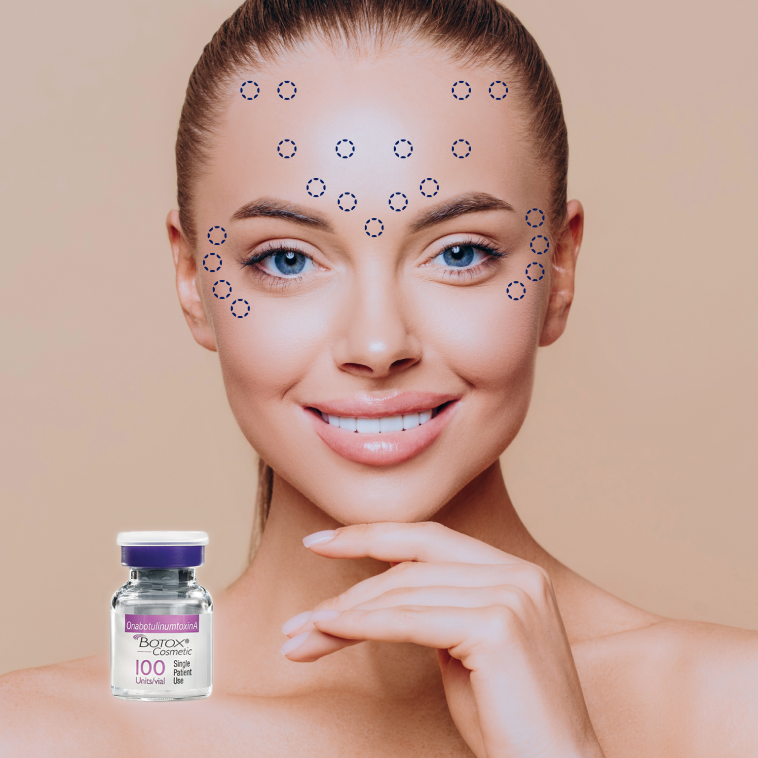 Anti-Wrinkle Injections 3 Areas | From £170